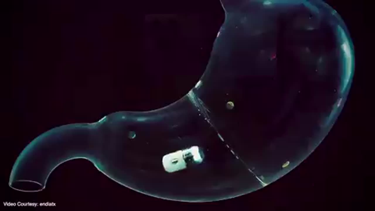 Pooraan Jaiswal on LinkedIn: #robot #pillbot #gastrointestinal #health ... Pooraan Jaiswal on LinkedIn: #robot #pillbot #gastrointestinal #health ...