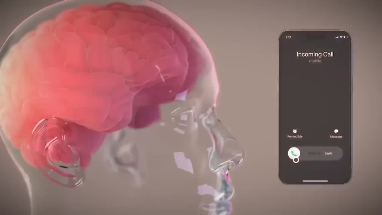 Aijaz Ahmad on LinkedIn: Elon Musk's Neuralink successfully implants ... Aijaz Ahmad on LinkedIn: Elon Musk's Neuralink successfully implants ...