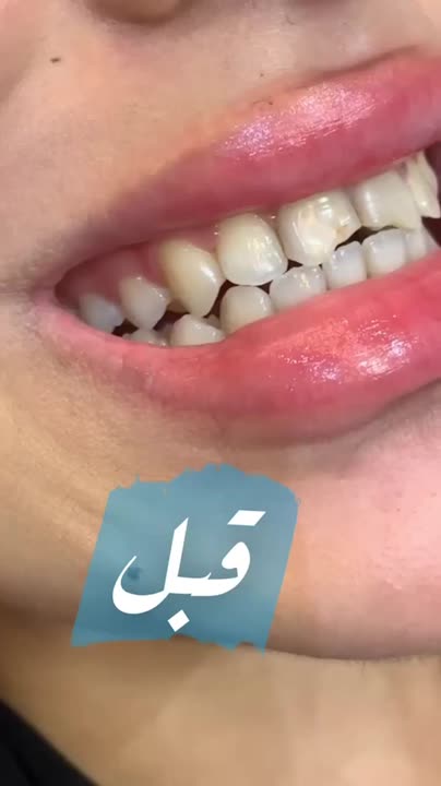 Dr Meral Alawad posted on LinkedIn Dr Meral Alawad posted on LinkedIn