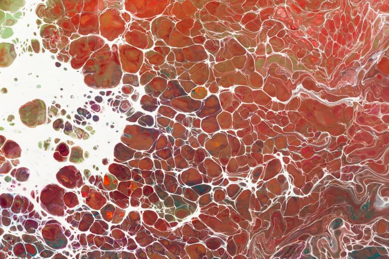 MediFormatica on LinkedIn: Fighting Rectal Cancer with AI: Researchers ... MediFormatica on LinkedIn: Fighting Rectal Cancer with AI: Researchers ...