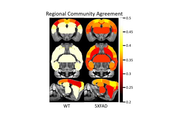 Newswise on LinkedIn: IU researchers develop new brain network modeling ... Newswise on LinkedIn: IU researchers develop new brain network modeling ...