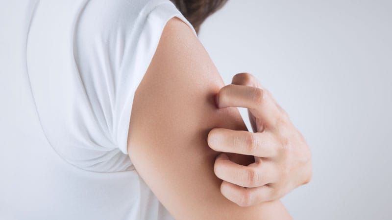 Juan Carlos Ivancevich on LinkedIn: Why Scratching Is So Contagious Juan Carlos Ivancevich on LinkedIn: Why Scratching Is So Contagious