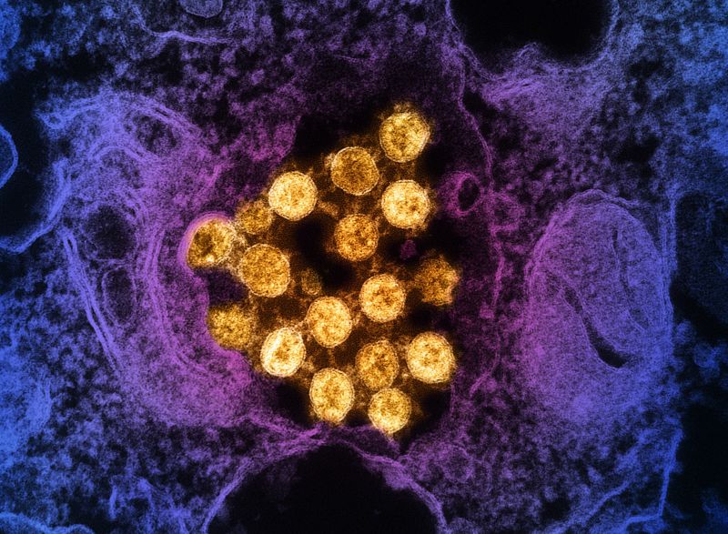 NIAID trial on COVID19 vaccine safety | National Institute of Allergy ... NIAID trial on COVID19 vaccine safety | National Institute of Allergy ...