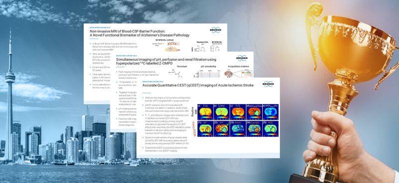 Bruker BioSpin on LinkedIn: Bruker MRI Award 2023 Bruker BioSpin on LinkedIn: Bruker MRI Award 2023
