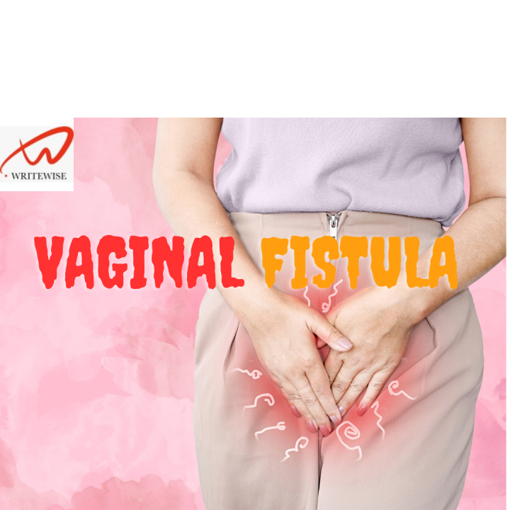 Understanding Vaginal Fistula: Causes, Symptoms, Treatment, and Prevention Understanding Vaginal Fistula: Causes, Symptoms, Treatment, and Prevention