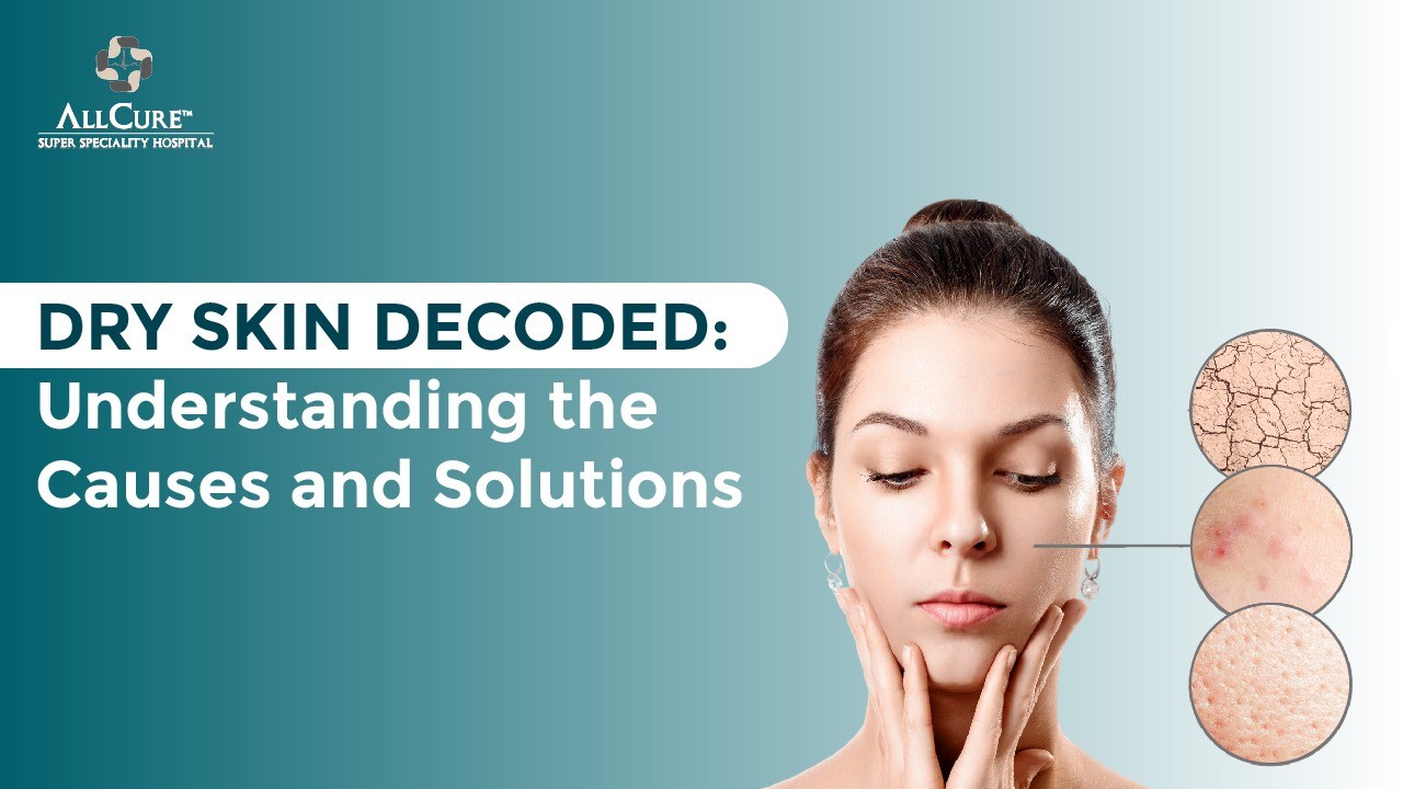 Dry Skin Decoded: Understanding the Causes and Solutions Dry Skin Decoded: Understanding the Causes and Solutions