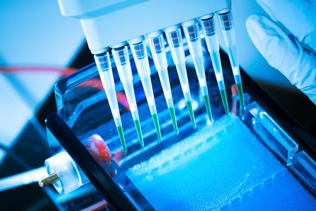 Agarose Precast Gel Market Analysis, Challenges, Growth and Forecast By ... Agarose Precast Gel Market Analysis, Challenges, Growth and Forecast By ...