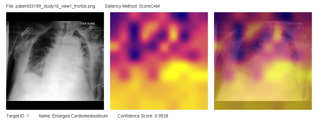 Bringing AI To Medical Imaging Bringing AI To Medical Imaging