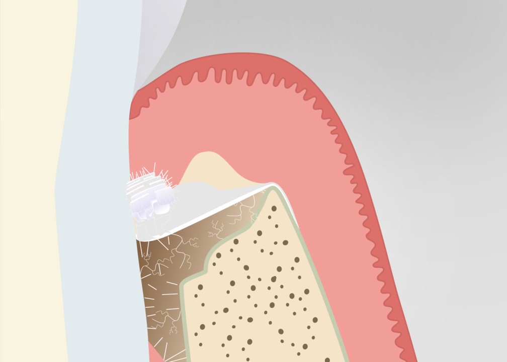 Optimizing Dental CAD/CAM Systems: Elevating User Experience in Dentistry Optimizing Dental CAD/CAM Systems: Elevating User Experience in Dentistry