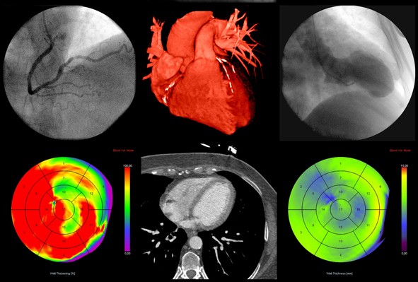 Understanding the Different Types of Imaging Tests Understanding the Different Types of Imaging Tests