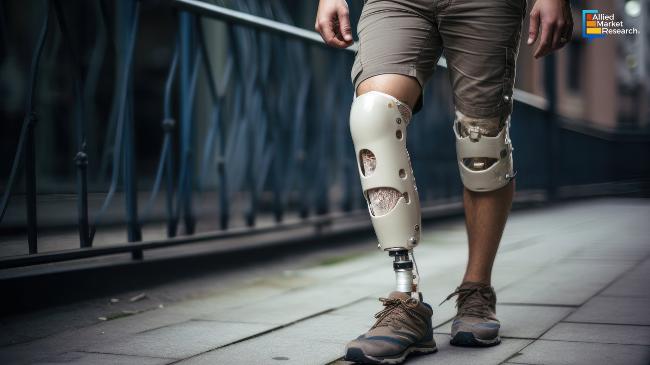 AI in Bionic Prosthetics: Transforming Lives AI in Bionic Prosthetics: Transforming Lives