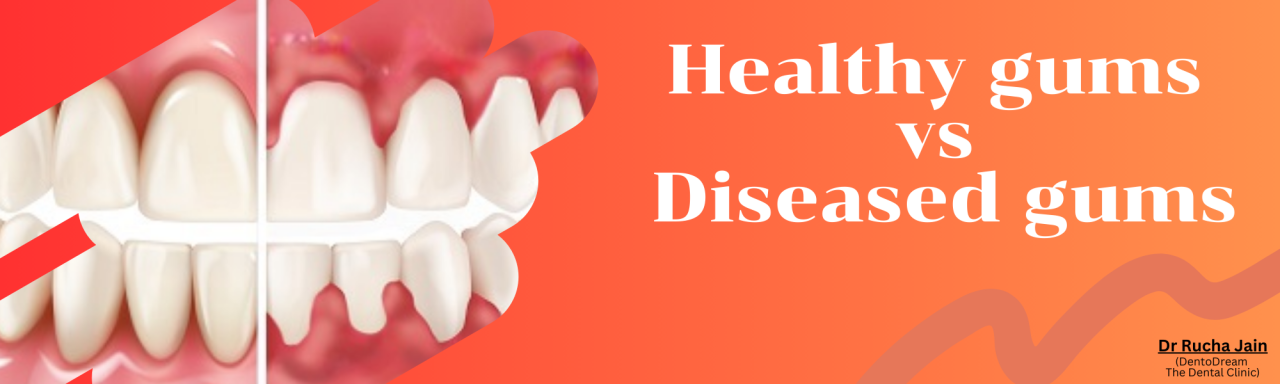 Deciphering the Language of Gums: A Guide to Oral Health Deciphering the Language of Gums: A Guide to Oral Health