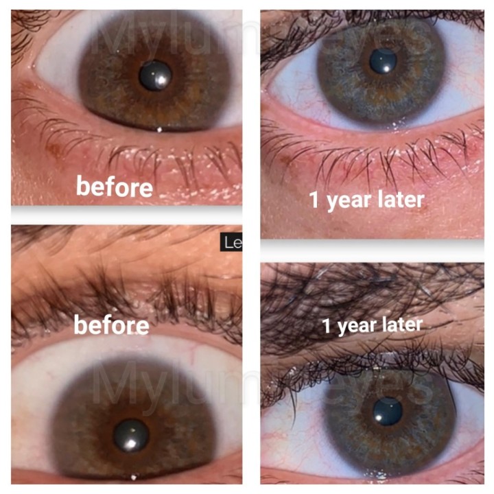 can you change your eye color naturally? can you change your eye color naturally?