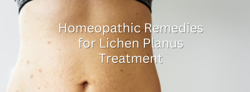 Homeopathic Treatment for Lichen Planus: A Comprehensive Guide Homeopathic Treatment for Lichen Planus: A Comprehensive Guide