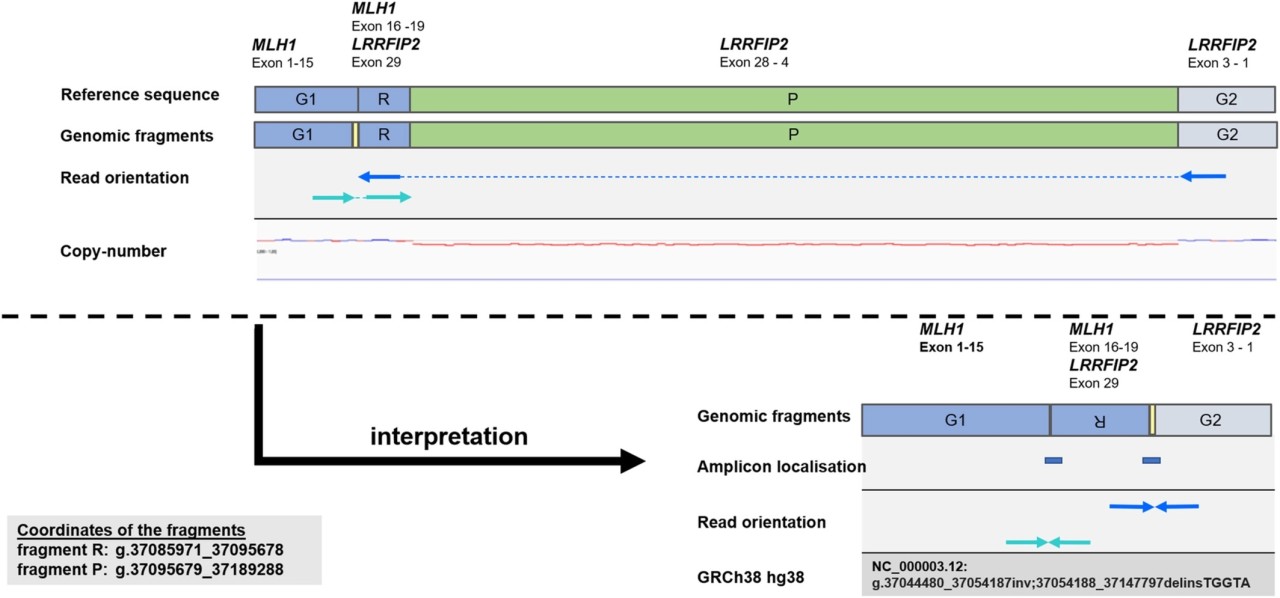 Using Whole Genome Sequencing to identify a complex structural variant Using Whole Genome Sequencing to identify a complex structural variant
