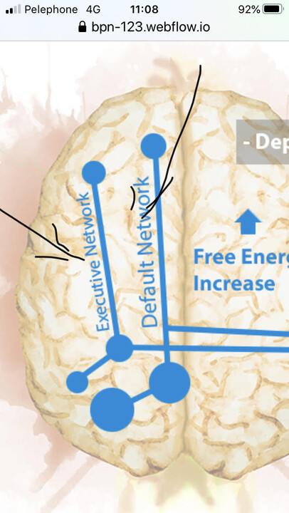 tDCS Treatment for Negative Signs Schizophrenia tDCS Treatment for Negative Signs Schizophrenia