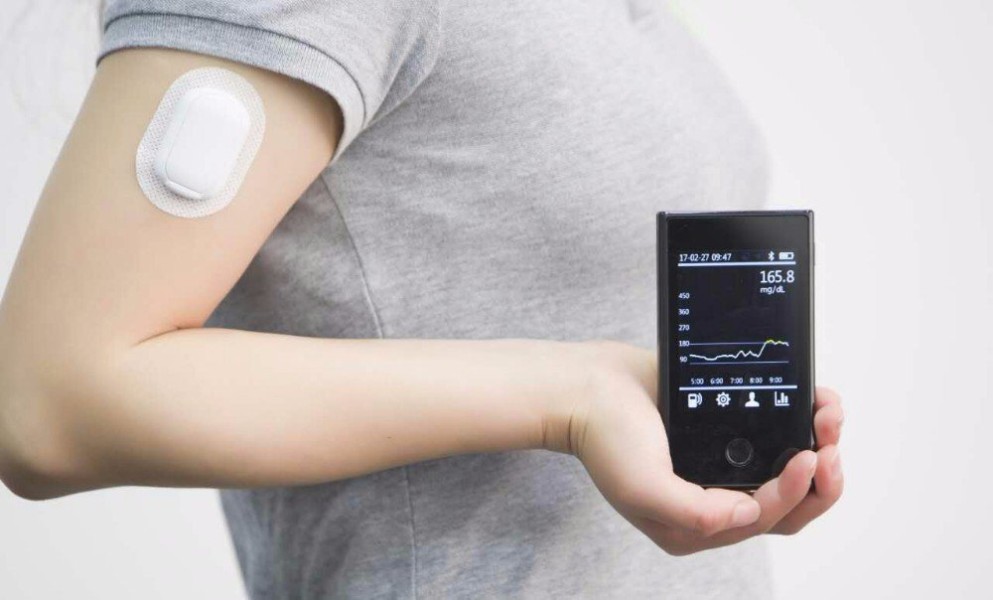 Revolutionary Growth Expected in Global Continuous Glucose Monitoring ... Revolutionary Growth Expected in Global Continuous Glucose Monitoring ...