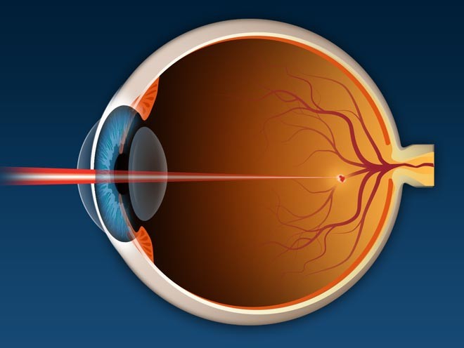 Illuminating Hope: Breakthroughs in the Macular Degeneration Treatment ... Illuminating Hope: Breakthroughs in the Macular Degeneration Treatment ...