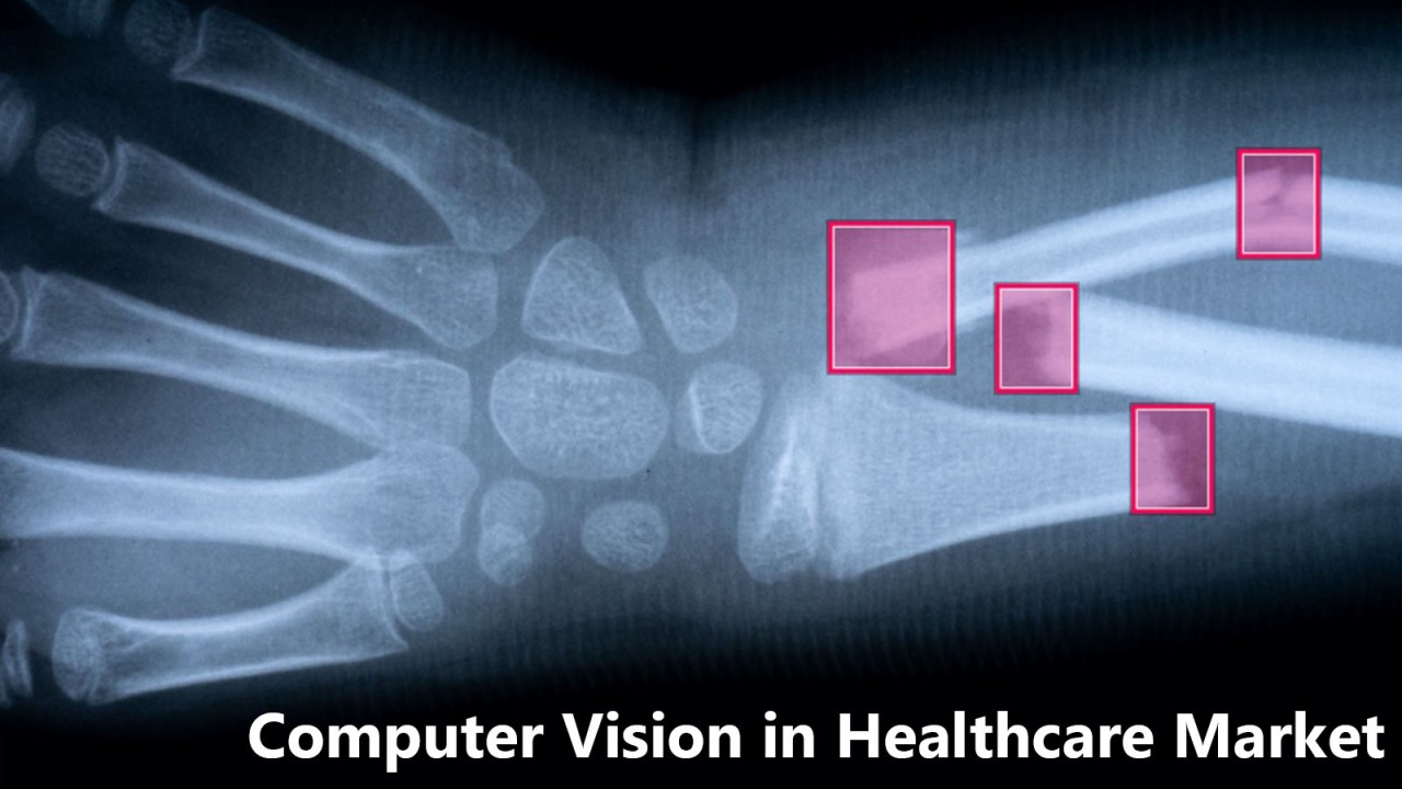 How Computer Vision is Revolutionizing the Healthcare Industry How Computer Vision is Revolutionizing the Healthcare Industry