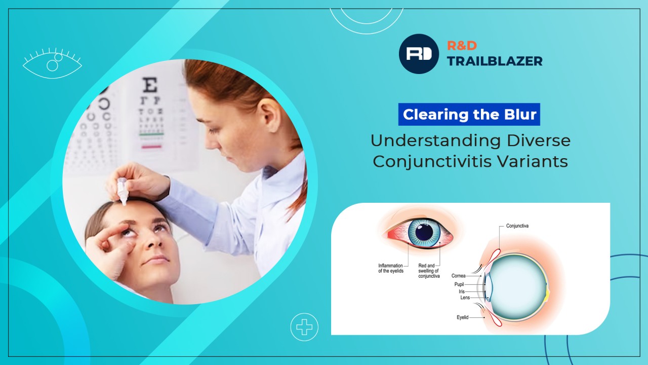 ๐๐๏ธ๐Clearing the Blur: Understanding Diverse Conjunctivitis Variants ๐ท๐๐ค ๐๐๏ธ๐Clearing the Blur: Understanding Diverse Conjunctivitis Variants ๐ท๐๐ค