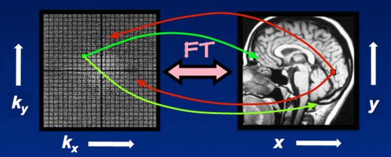 Fourier Transform Applications In Medical Imaging Fourier Transform Applications In Medical Imaging