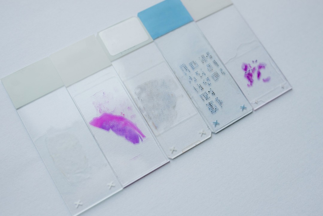 Computational Methods Revolutionizing Prostate Tissue Analysis Computational Methods Revolutionizing Prostate Tissue Analysis