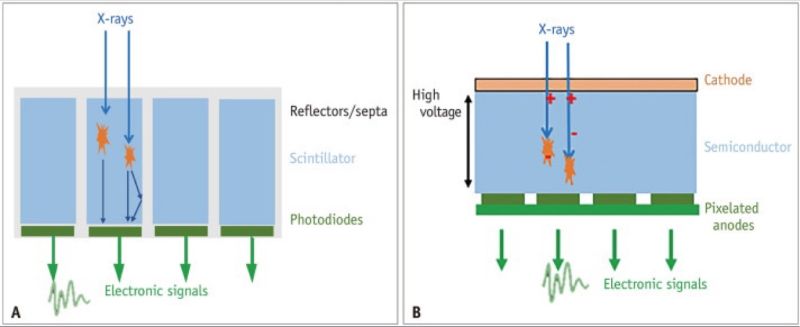 Mohammed Alkhamesy on LinkedIn: Photon-counting detector computed ... Mohammed Alkhamesy on LinkedIn: Photon-counting detector computed ...