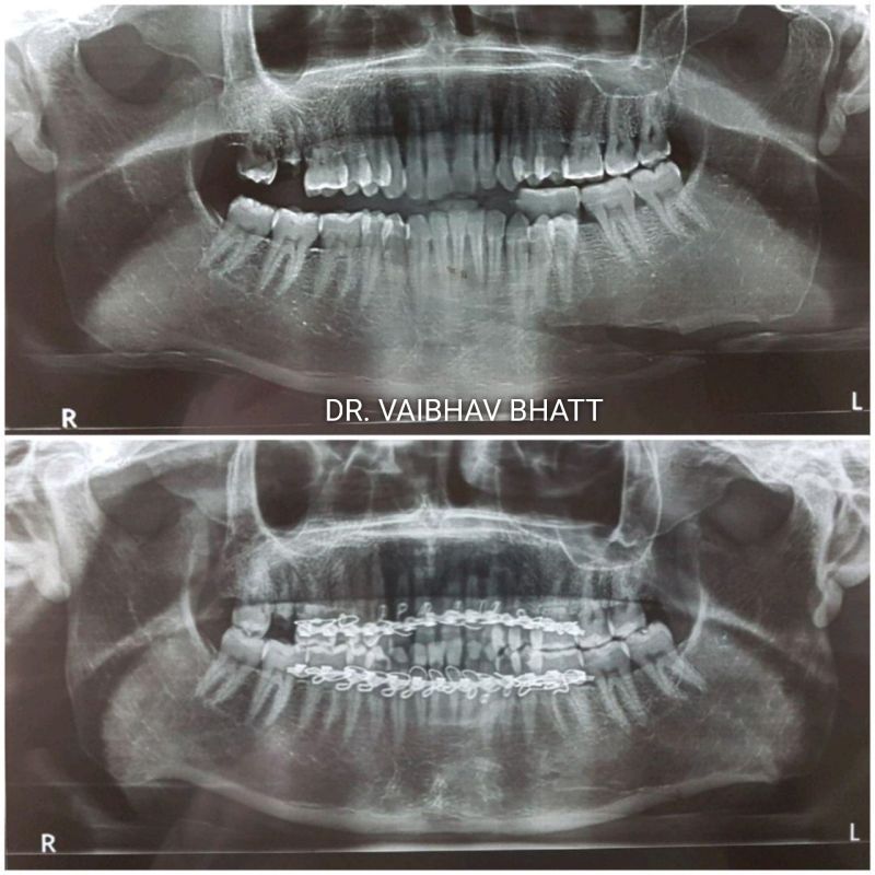 Dr vaibhav bhatt on LinkedIn: A vertically and horizontally ... Dr vaibhav bhatt on LinkedIn: A vertically and horizontally ...