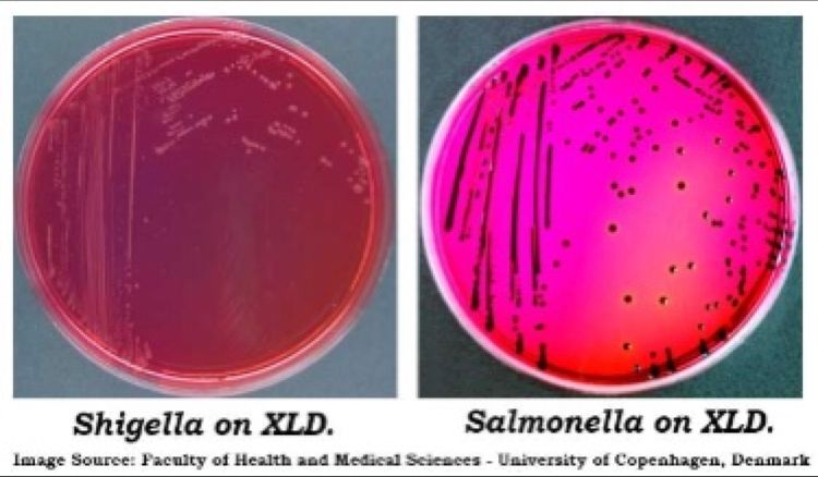 Ahmed Elhadi on LinkedIn: Difference between Salmonella & Shigella on ... Ahmed Elhadi on LinkedIn: Difference between Salmonella & Shigella on ...