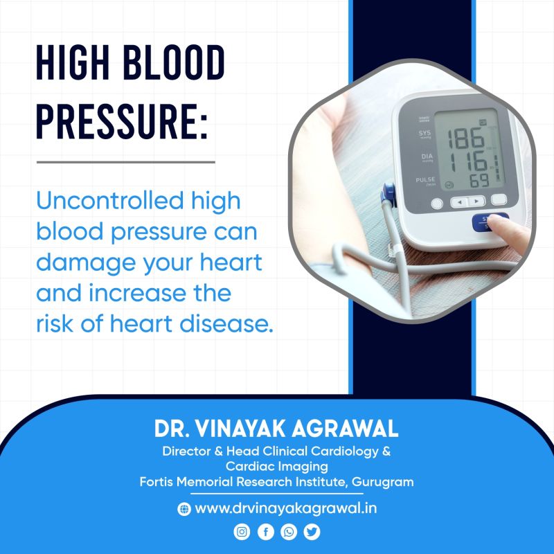 Dr Vinayak Agrawal on LinkedIn: #cardiology #cardiologist #cardiaccare ... Dr Vinayak Agrawal on LinkedIn: #cardiology #cardiologist #cardiaccare ...