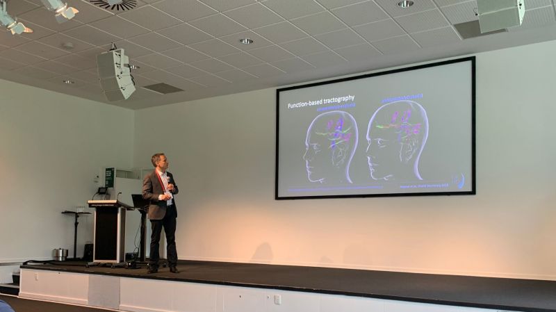 Nexstim on LinkedIn: #ntms #neurosurgery #brainmapping #tractography # ... Nexstim on LinkedIn: #ntms #neurosurgery #brainmapping #tractography # ...