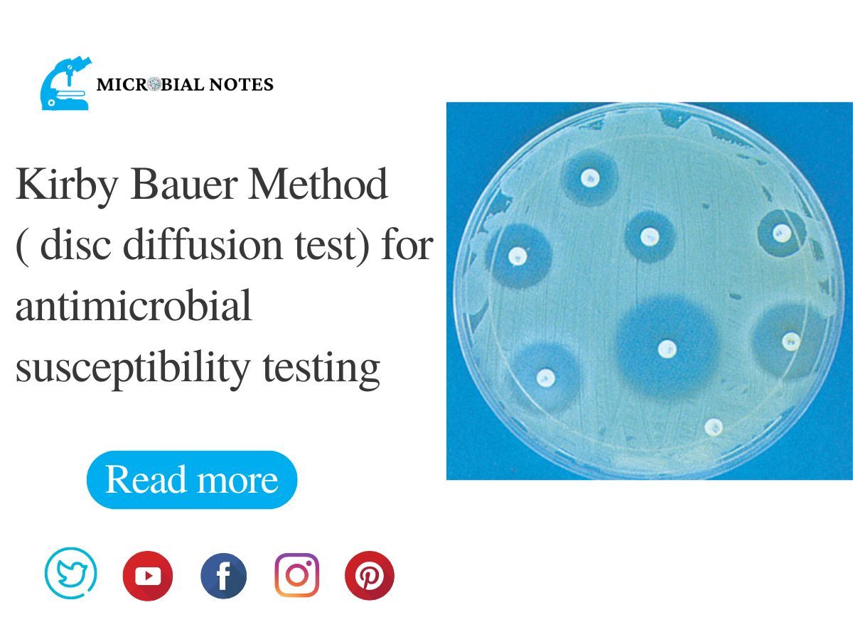 Microbial Notes on LinkedIn: Kirby Bauer Method ( disc diffusion test ... Microbial Notes on LinkedIn: Kirby Bauer Method ( disc diffusion test ...