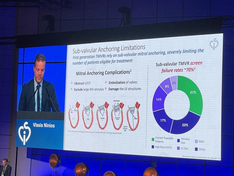 Saravana Kumar on LinkedIn: #csifrankfurt2024 Saravana Kumar on LinkedIn: #csifrankfurt2024