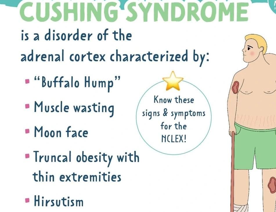 Dr. Tarun Shukla on LinkedIn: Signs of Cushings Syndrome Dr. Tarun Shukla on LinkedIn: Signs of Cushings Syndrome