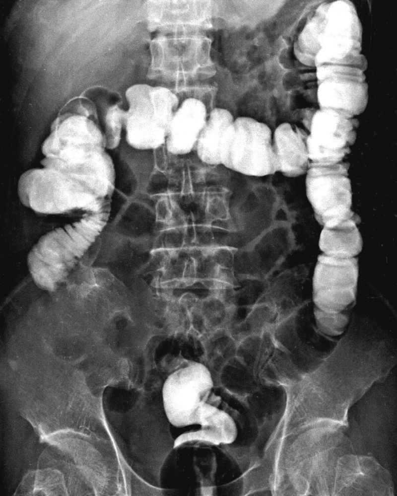 Mohammad Irfan on LinkedIn: #radiographer #radiology #radiologia # ... Mohammad Irfan on LinkedIn: #radiographer #radiology #radiologia # ...