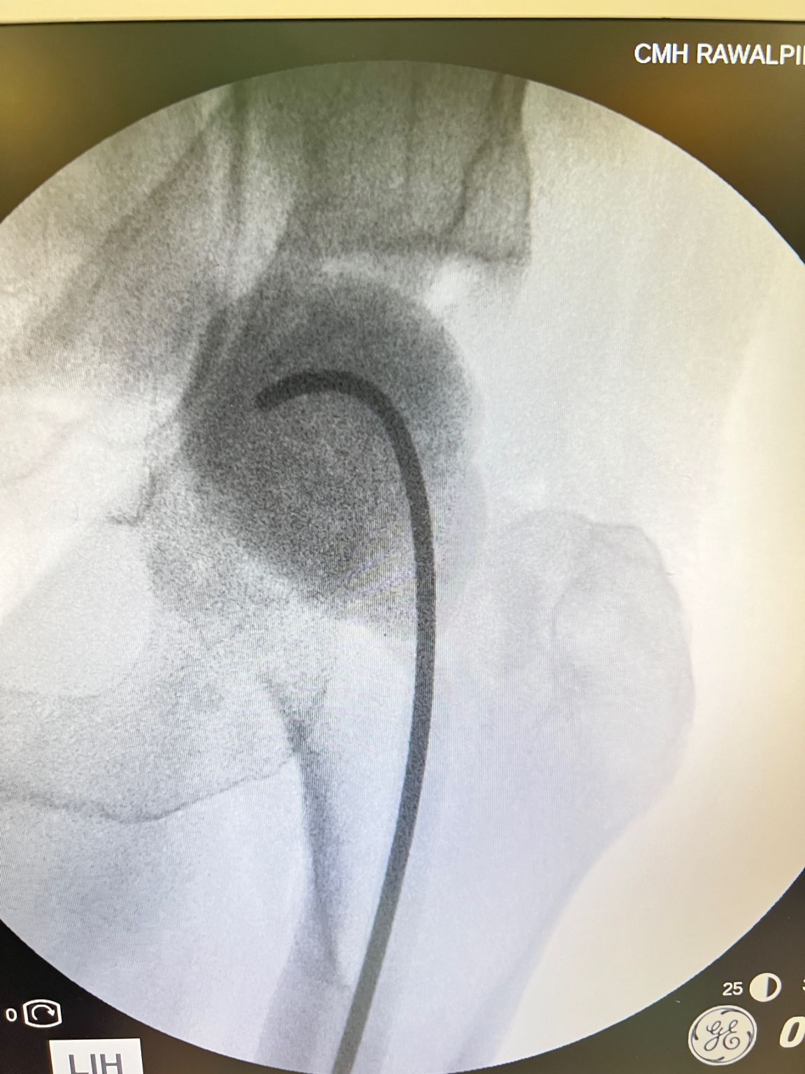 Dr Muhammad Haseeb on LinkedIn: #ortho Dr Muhammad Haseeb on LinkedIn: #ortho