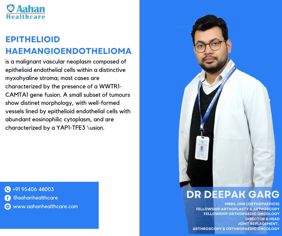 Dr. Deepak Garg on LinkedIn: #orthopedics #drdeepakgarg # ... Dr. Deepak Garg on LinkedIn: #orthopedics #drdeepakgarg # ...