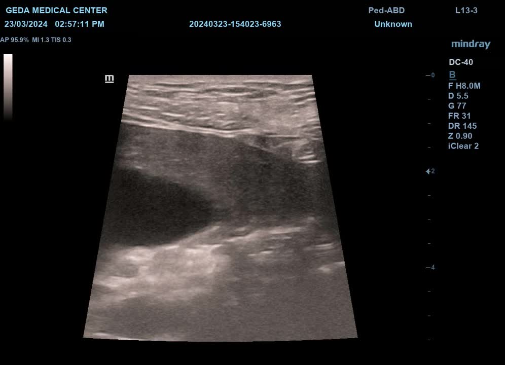 Mohammed Hamid on LinkedIn: 50 years old female present with dyspeptic ... Mohammed Hamid on LinkedIn: 50 years old female present with dyspeptic ...