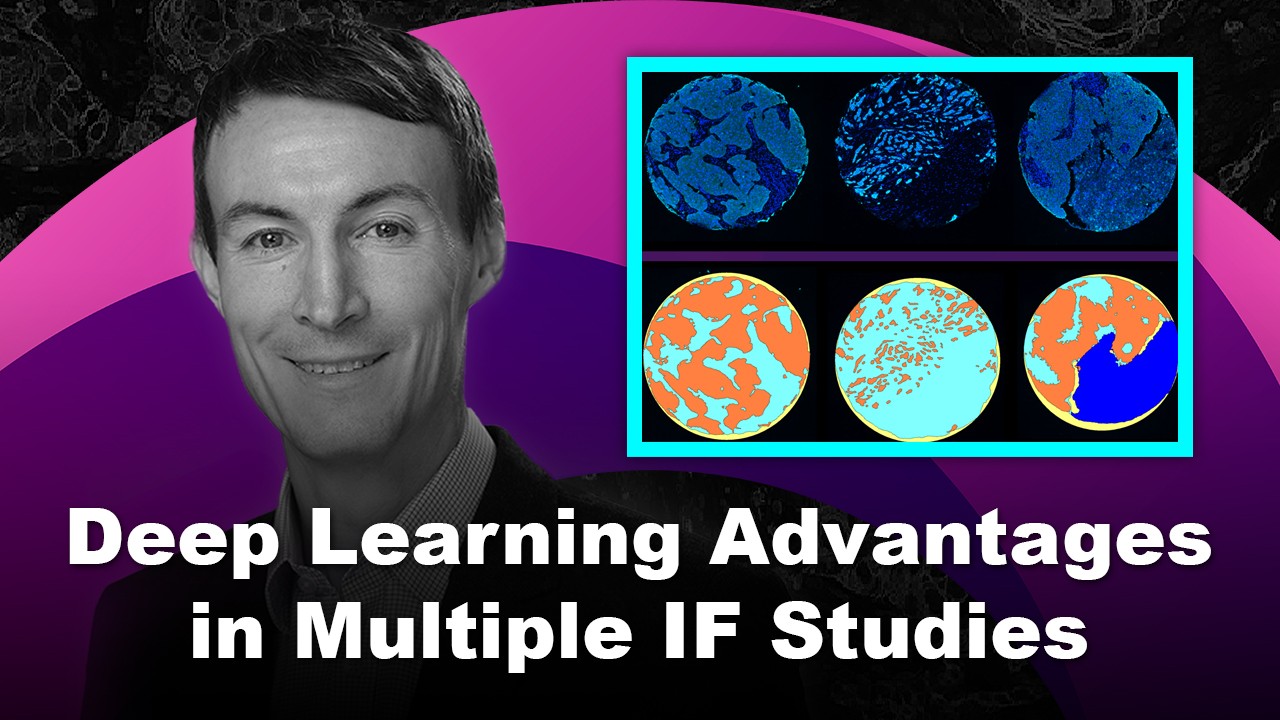 OracleBio on LinkedIn: Advantages of implementing Deep Learning for ... OracleBio on LinkedIn: Advantages of implementing Deep Learning for ...