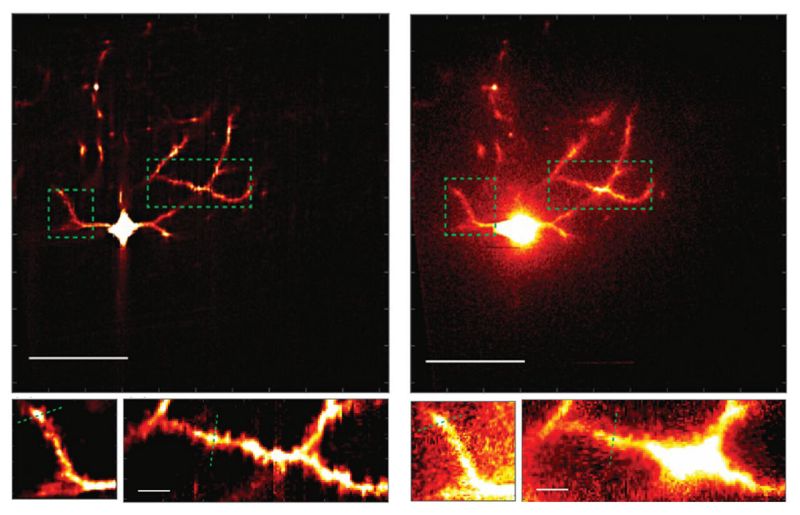Medical Xpress on LinkedIn: Microscope system sharpens scientists' view ... Medical Xpress on LinkedIn: Microscope system sharpens scientists' view ...