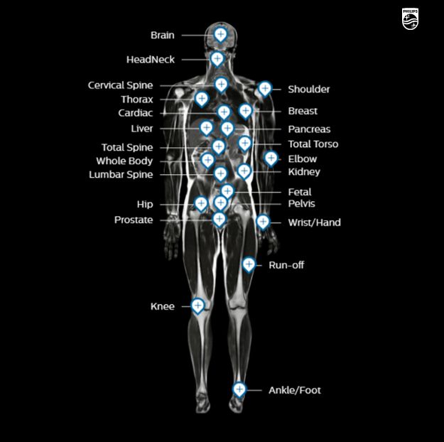 Anil Gupta on LinkedIn: #mrbodymap Anil Gupta on LinkedIn: #mrbodymap
