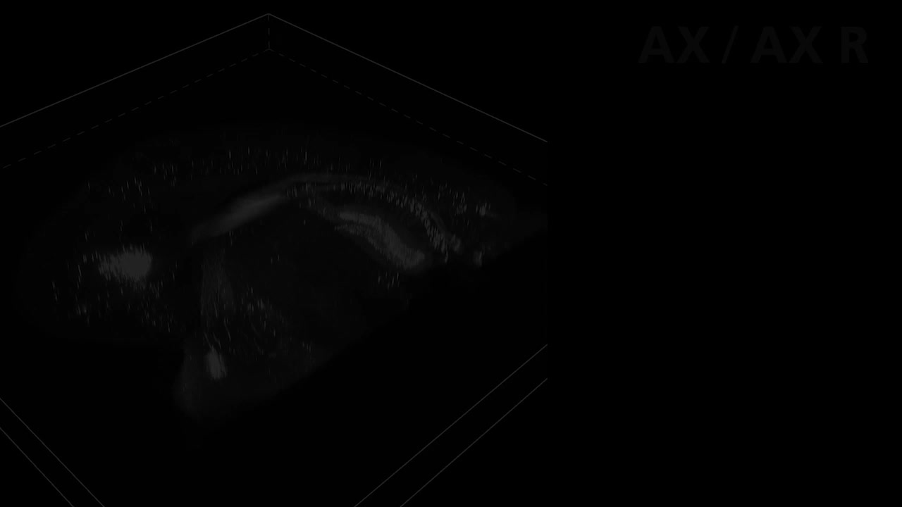rohit kumar singh on LinkedIn: Nikon Spatial Array Confocal (NSPARC ... rohit kumar singh on LinkedIn: Nikon Spatial Array Confocal (NSPARC ...