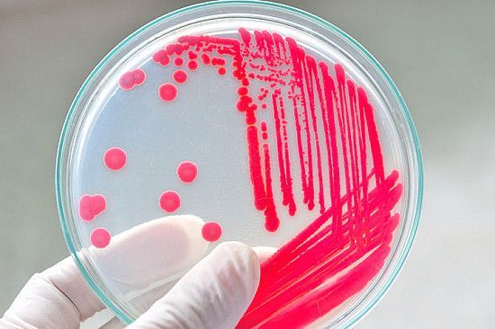 Harvard Health Publishing on LinkedIn: Long-lasting C. diff infections ... Harvard Health Publishing on LinkedIn: Long-lasting C. diff infections ...