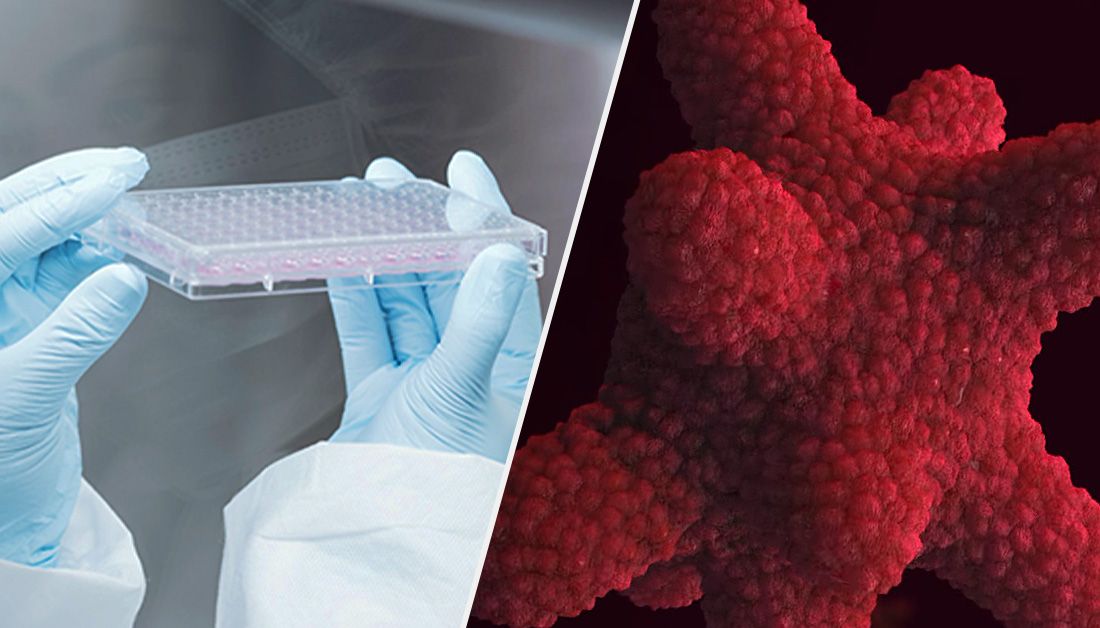 STEMCELL Technologies on LinkedIn: Applications of Human Intestinal ... STEMCELL Technologies on LinkedIn: Applications of Human Intestinal ...