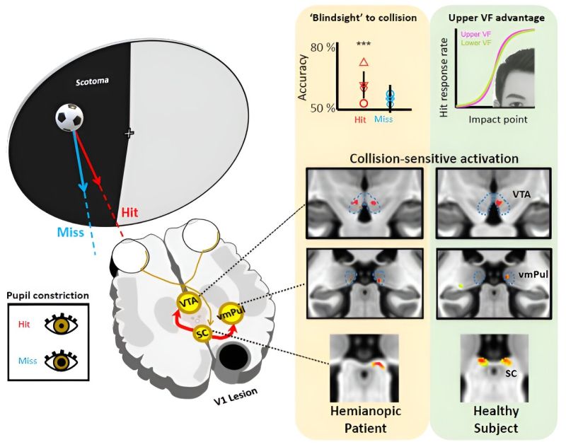 Phys.org on LinkedIn: Researchers reveal human brain mechanisms for ... Phys.org on LinkedIn: Researchers reveal human brain mechanisms for ...