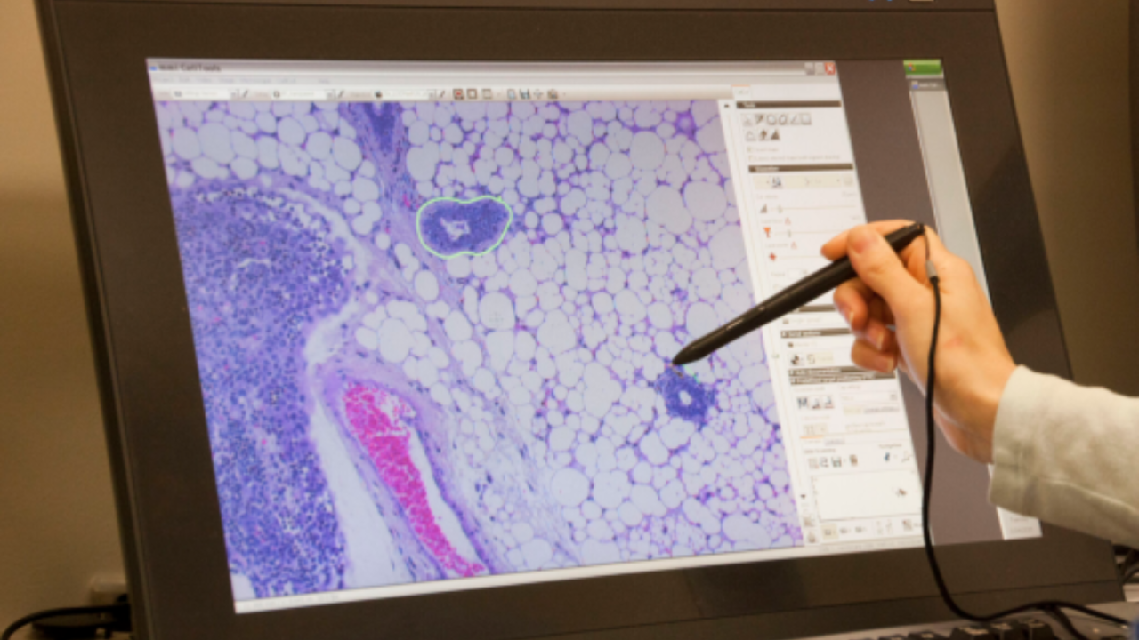 Laser Capture Microdissection Technology Exponentially Expands Research ... Laser Capture Microdissection Technology Exponentially Expands Research ...