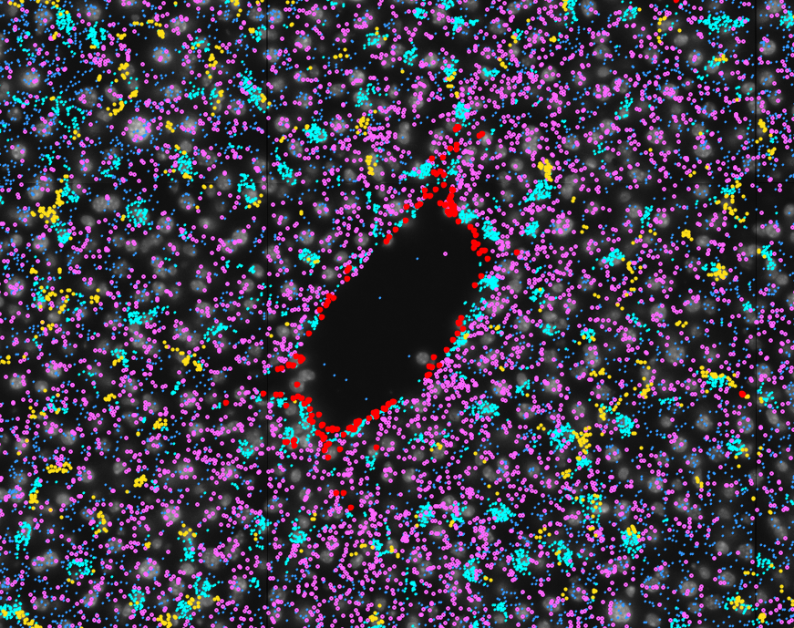 Limitations and quality metrics of imaging-based spatial ... Limitations and quality metrics of imaging-based spatial ...
