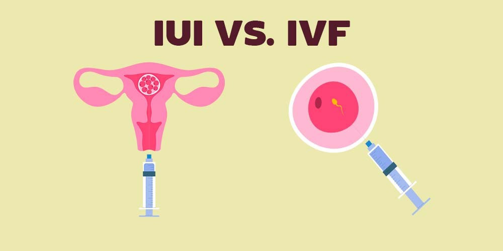 IUI VS IVF IUI VS IVF
