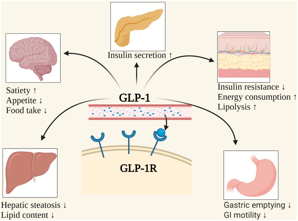 Transforming Diabetes Management: The Role of GLP-1 Receptor Agonists 🩸💼 Transforming Diabetes Management: The Role of GLP-1 Receptor Agonists 🩸💼