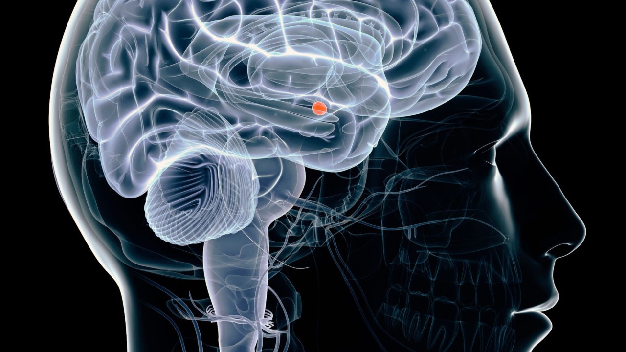 Fight, Flight, or Freeze: How Does Your Body React to Stress? Fight, Flight, or Freeze: How Does Your Body React to Stress?
